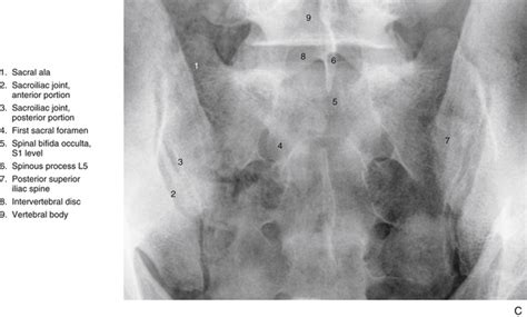 Sacrum And Coccyx X Ray