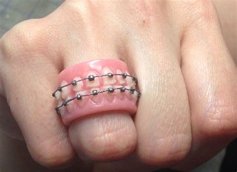 Braces Ring Etsy