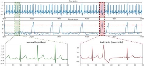 norma automated anomaly detection in large sequences paul boniol