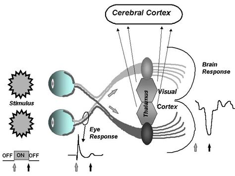 Journal And Conferences On Biomedical Engineering Enhancing Visual Evoked Potentials Detection