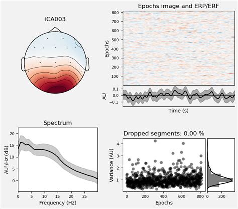 Artifacts In EEG Data Neural Data Science In Python
