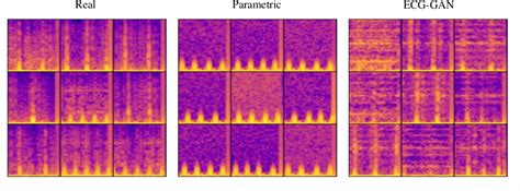 Figure 2 From A Generative Adversarial Approach To Ecg Synthesis And Denoising Semantic Scholar