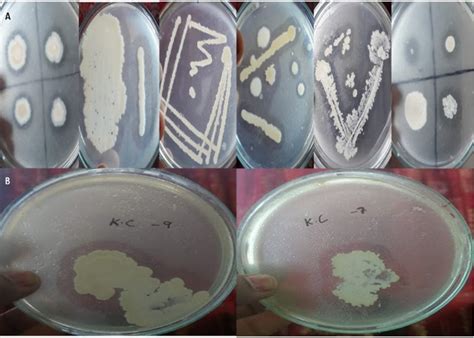 Optimization And Molecular Characterization Of Lipase Producing