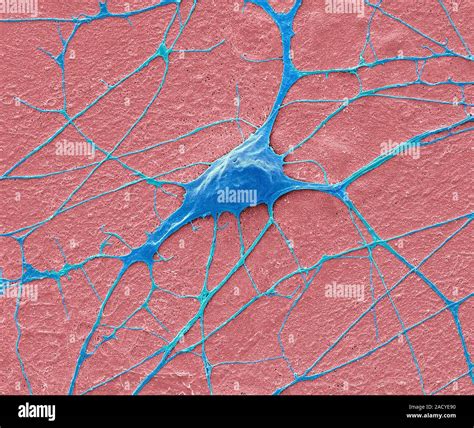 Stem Cell Derived Motor Neuron Coloured Scanning Electron Micrograph Sem Of A Human Nerve