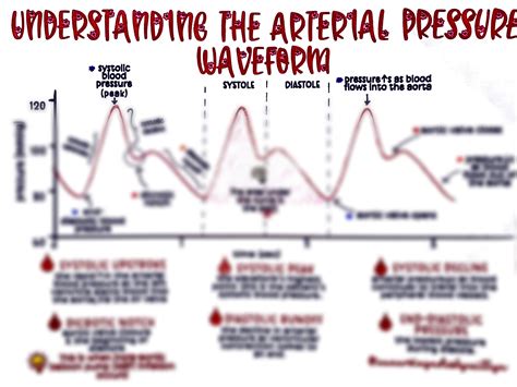 Art Line Waveform Explanation Mindi Weston