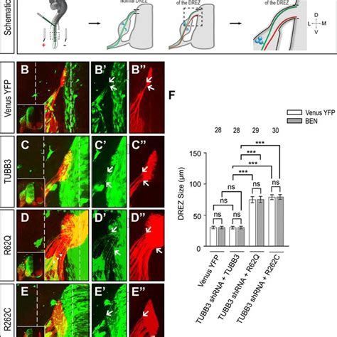 Tubb3 Mutations Inhibit Netrin 1 Induced Neurite Outgrowth Of Cortical Download Scientific