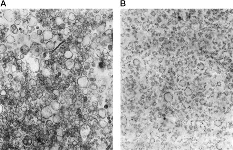 Electron Micrographs Of Smooth And Rough Microsomes A Smooth