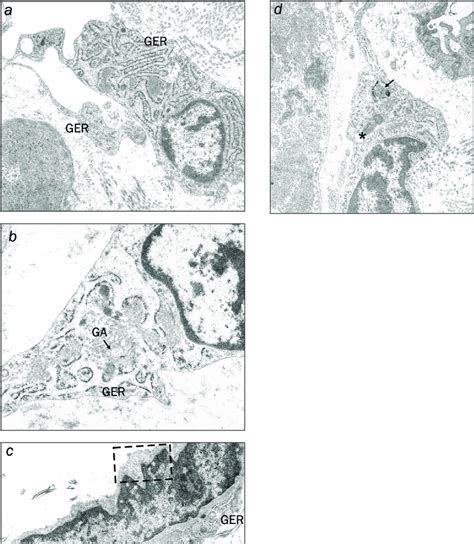 Ultrastructural Features Of The Perinuclear Zone Of Tc Electron Download Scientific Diagram