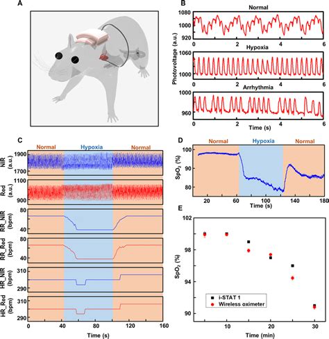 In Vivo Demonstration Of Real Time Monitoring Of Cardiac Physiology In Download Scientific