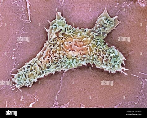 Macrophage Cell Coloured Scanning Electron Micrograph Sem Of A
