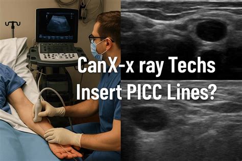 Can X Ray Techs Insert PICC Lines