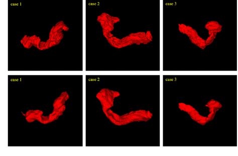 Figure 7 From Cascaded Multitask 3 D Fully Convolutional Networks For