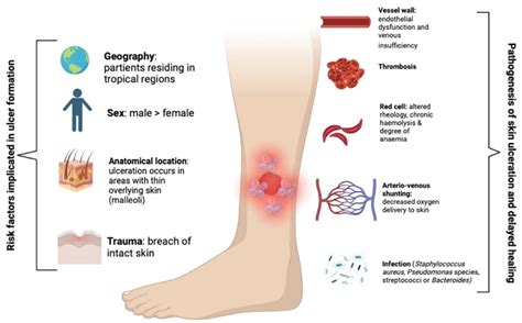 Musculoskeletal And Somatic Manifestations Of Haematological Disease A