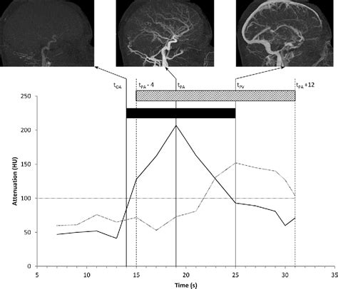 Figure 1 From Radiation Dose Reduction In 4d Cerebral Ct Angiography By Individualized