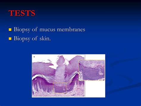 Ppt Ectodermal Dysplasia Dental Calamity In Your Mouth Powerpoint Presentation Id 4426526