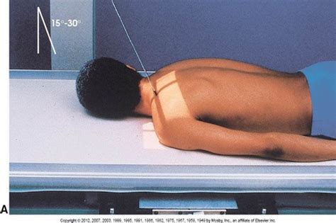 pa axial projection tangential clavicle flashcards quizlet