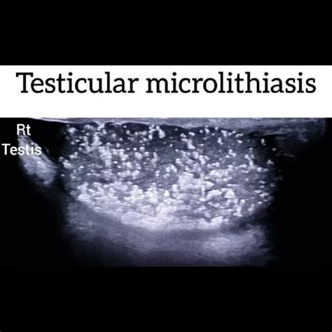 Video Daniel Ben Mordechay On Linkedin Ultrasound Pocus Tm