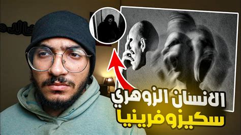 الانسان الزوهري الخادم المخلص سكيزوفرنيا Youtube