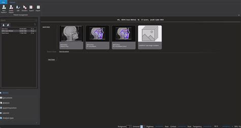Owandy Ceph Analysis Orthodontic Software Panrad