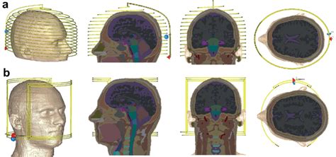 Schematics Of The Simulated Semi Elliptical Helix Coil A And Saddle Download Scientific