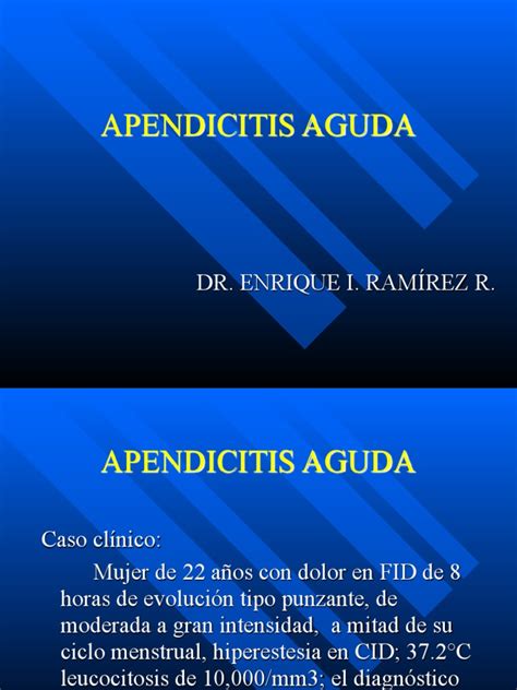 Mcburney Sign Hace Referencia Al Signo De Mcburney Que Es Uno De Los
