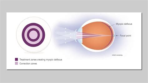 Angus Mcphie Optometrists