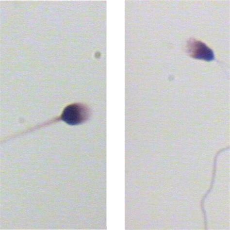 PDF Effects Of Six Kinds Of Sperm Staining Methods On Human Sperm Size And Evaluation Of Their