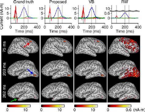 Figure 4 From A State Space Modeling Approach For Localization Of Focal