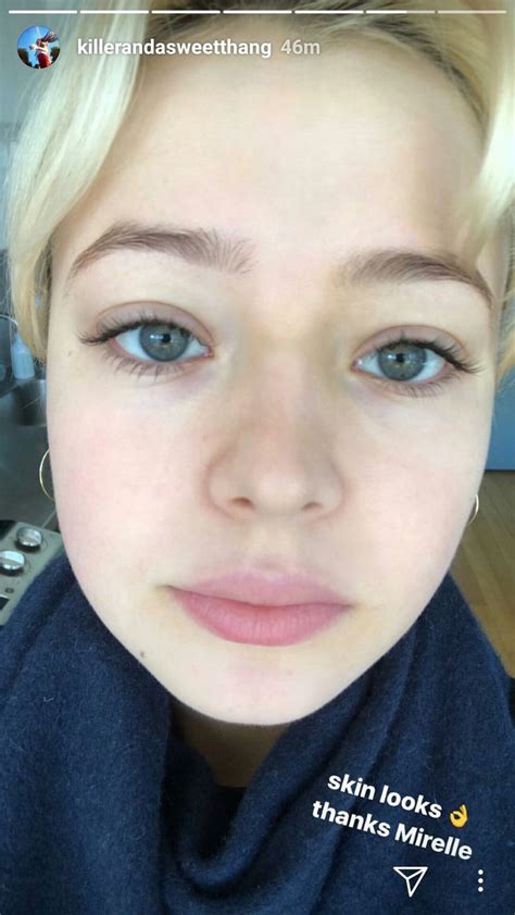 Eileen Kelly Skin Face