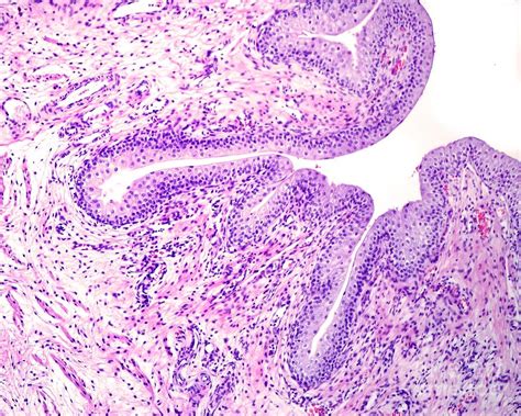 Urinary Bladder Mucosa 2 By Science Photo Library