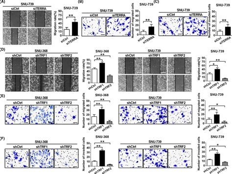 Telomeric Repeat‐containing Rna Terra Inhibited Hepatocellular
