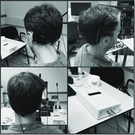 Tdcs Setup Anode Over F4 Cathode Over Contralateral Mastoid