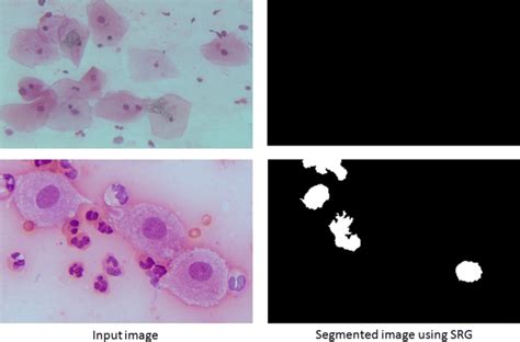 Segmented Image Using Seed Region Growing Download Scientific Diagram