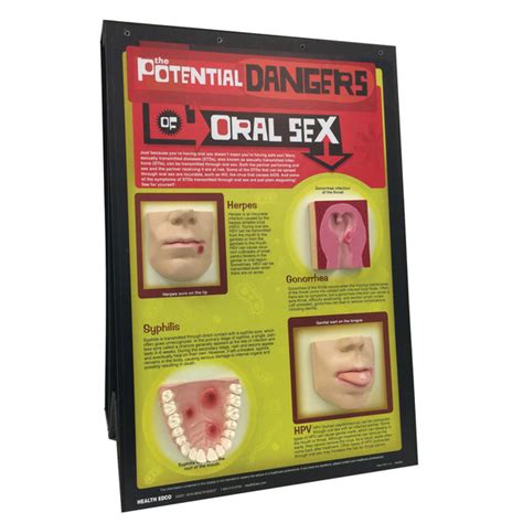Oral Sex Potential Dangers Diseases Display Models Buyamag Inc