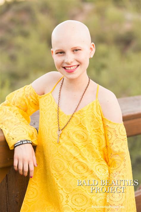 Abbie Bald Beauties Project®
