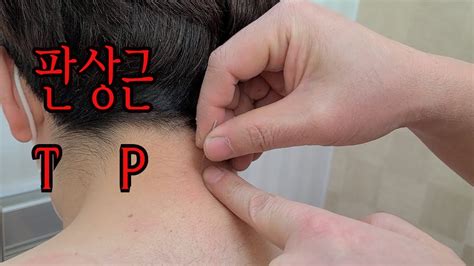 판상근 Tp 두판상근 경판상근 으로 구성됩니다 Youtube