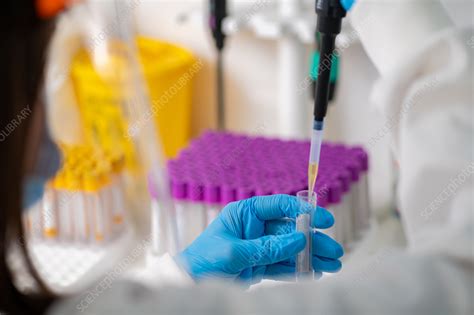 Lab Technician Pipetting A Sample Stock Image F037 2524 Science Photo Library