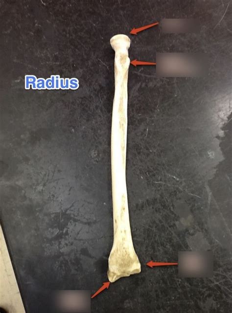 Radius Diagram Quizlet