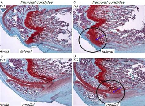 Col10a1 Runx2 Transgenic Mice With Delayed Chondrocyte Maturation Are