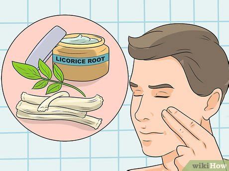 Ways To Get Rid Of Red Acne Marks WikiHow Ways To Get Rid Of Red Acne Marks WikiHow