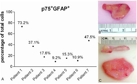 Figure 1 From Fibroblasts Isolated From Human Middle Turbinate Mucosa Cause Neural Progenitor