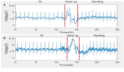 Figure 8 From Development Of Wearable Wireless Electrocardiogram Detection System Using