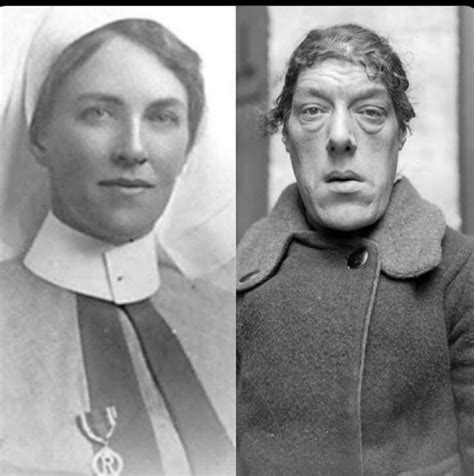 Mary Ann Bevan Van Normale Verpleegster Tot Circusster Dagblad Suriname