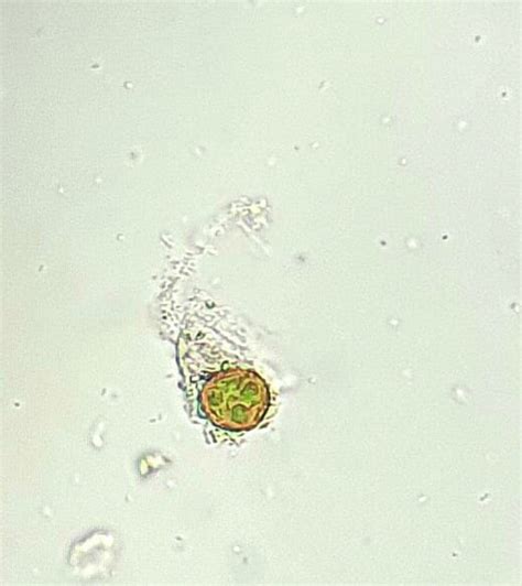 1613 Questions With Answers In Fungi Science Topic