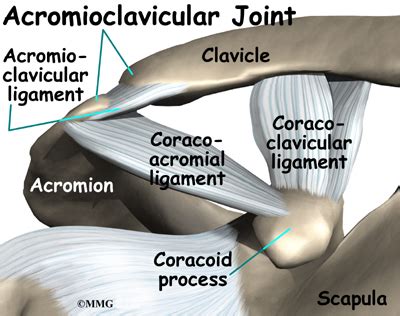 Osteoarthritis Of The Acromioclavicular Joint
