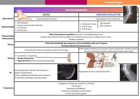 Osteocondrosis Marian Udocz