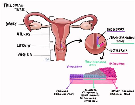 Atypical Squamous Cells Cervix