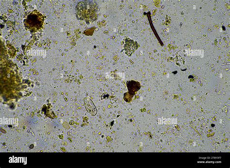 Microscopic Fungus And Microorganisms In A Sample In Australia Stock