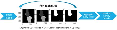 Github Brendan0403bonessegmentation Bones Segmentation By Deep Learning