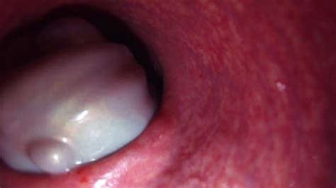 Camera Inside Asshole Penetration And Ejaculation